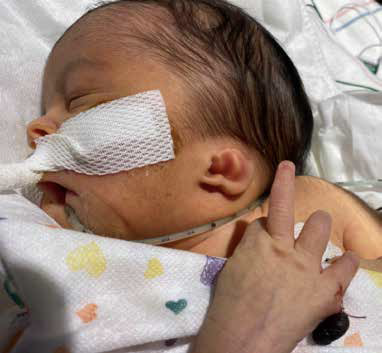 Genetics Corner: An infant with a CHARGE-like syndrome and dual ...